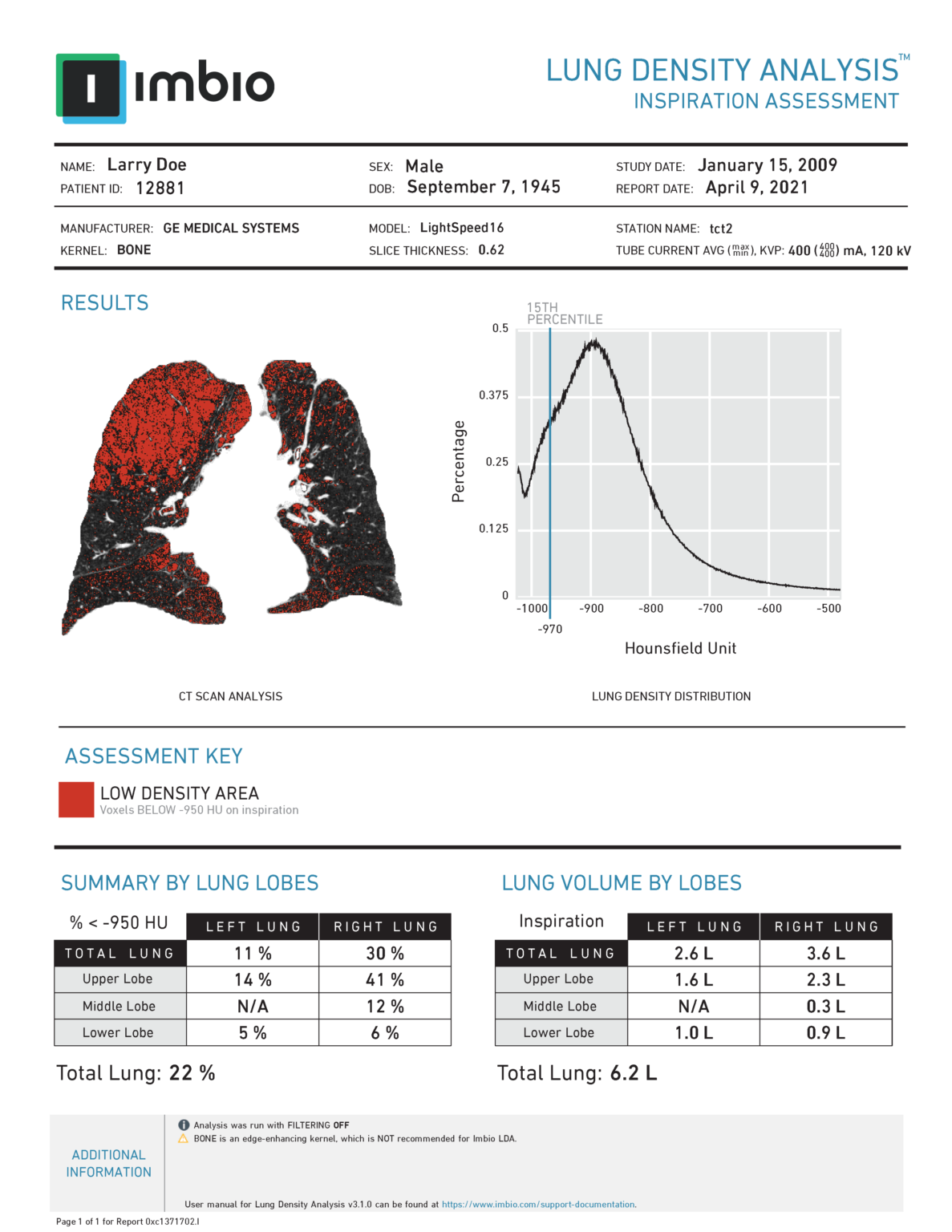 Lung Density Analysis™ - Inspiration - Imbio
